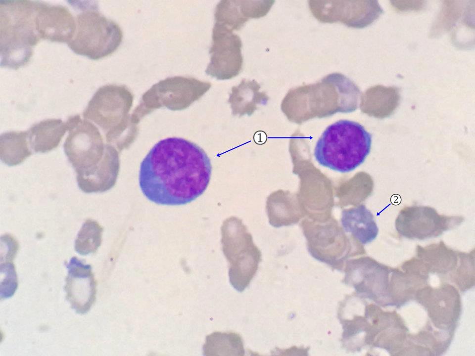 VETERINARY HEMATOLOGY DEXTERVET: 1 reactive lymphocytes 2 Polychromatic ...