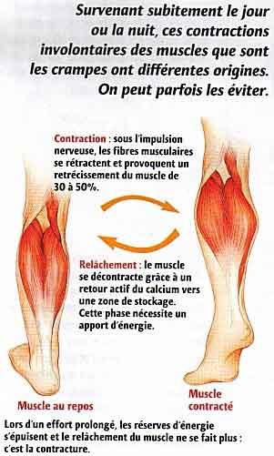 Les crampes | Récap' IDE