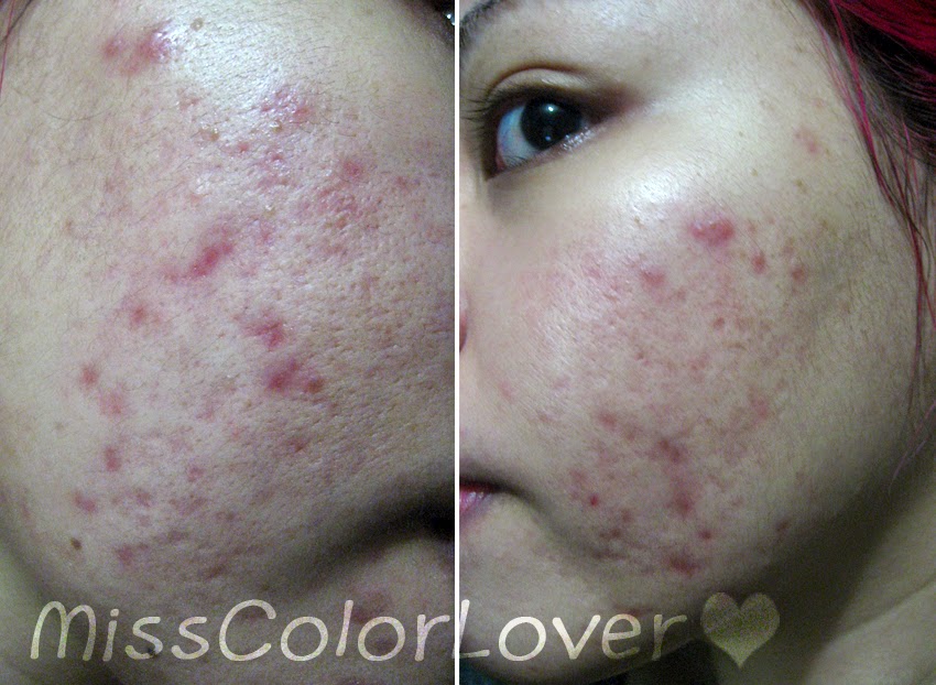 A Splash of Colorful Addictions!: Uguisu Poo (Uguisu no fun ...