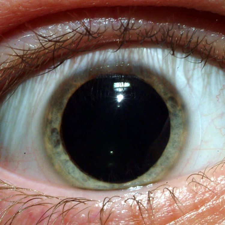 Actuaciencia: Fenotipo y genotipo