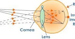 What is +plus and -Minus number of eye glasses?? - Learn Something New