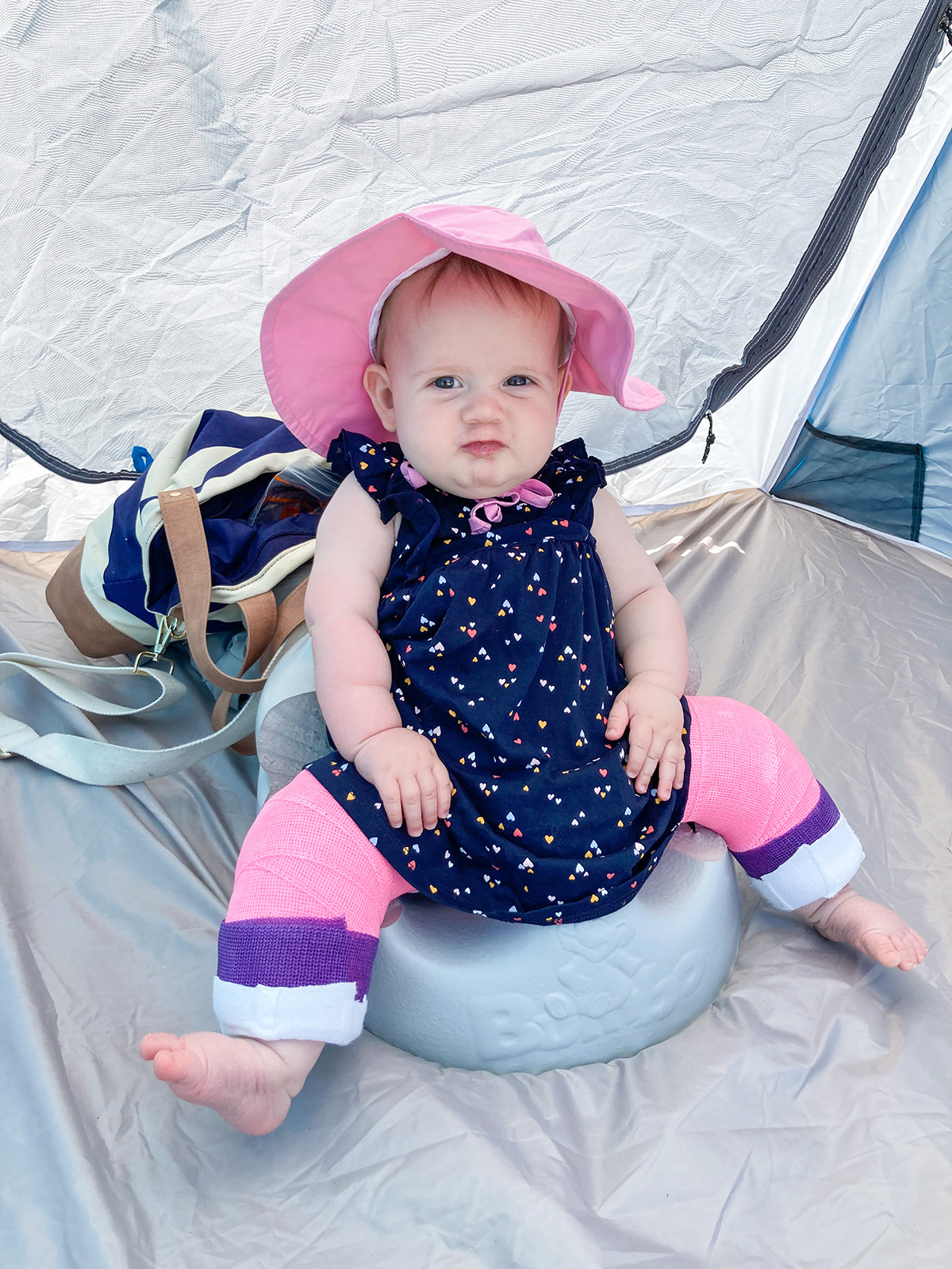 How to Survive (and Thrive!) with a Hip Spica Cast - The Baker Upstairs