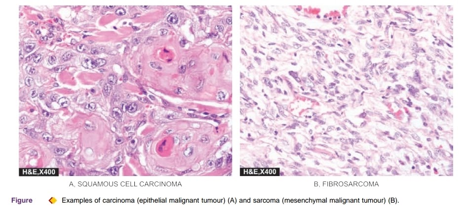 NEOPLASIA (NOMENCLATURE AND CLASSIFICATION)