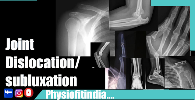 Joint Dislocation/subluxation,Complications in joint Dislocation ...