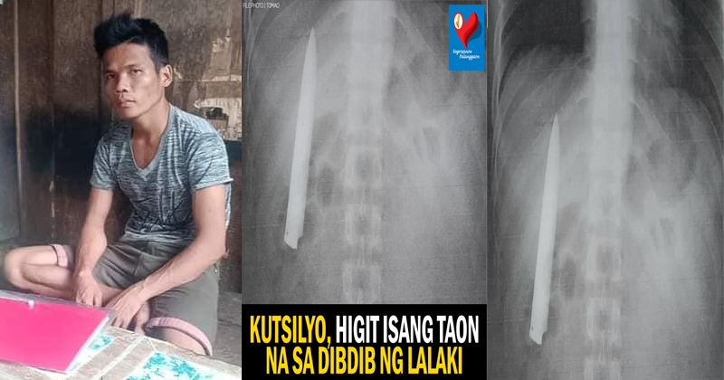 WATCH| Isang Lalaki may nakabaong Kutsilyo sa Katawan ng hindi niya ... WATCH| Isang Lalaki may nakabaong Kutsilyo sa Katawan ng hindi niya ...