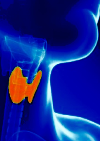 HealthSalus: HYPERTHYROIDISM, WHEN THE THYROID INCREMENTS ITS FUNCTION.