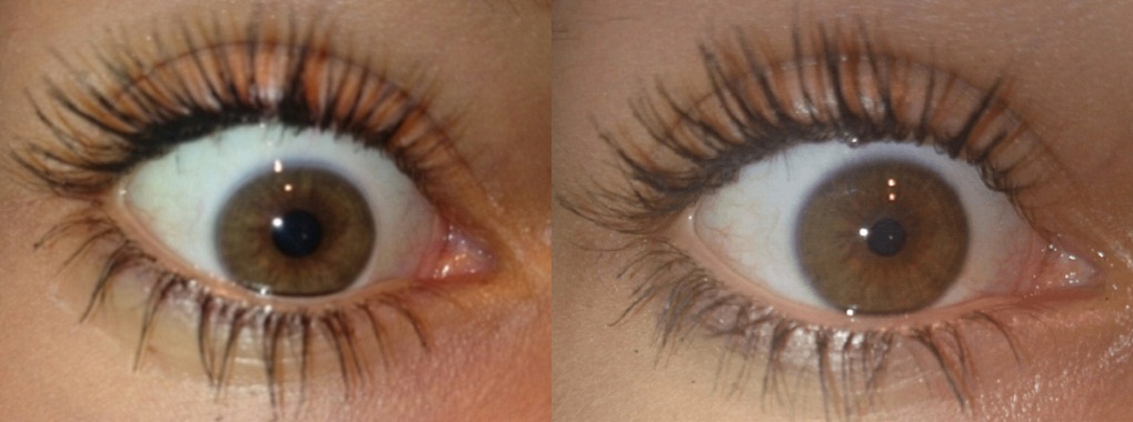 Ellavita: Remède de grand-mère pour éclaircir les yeux