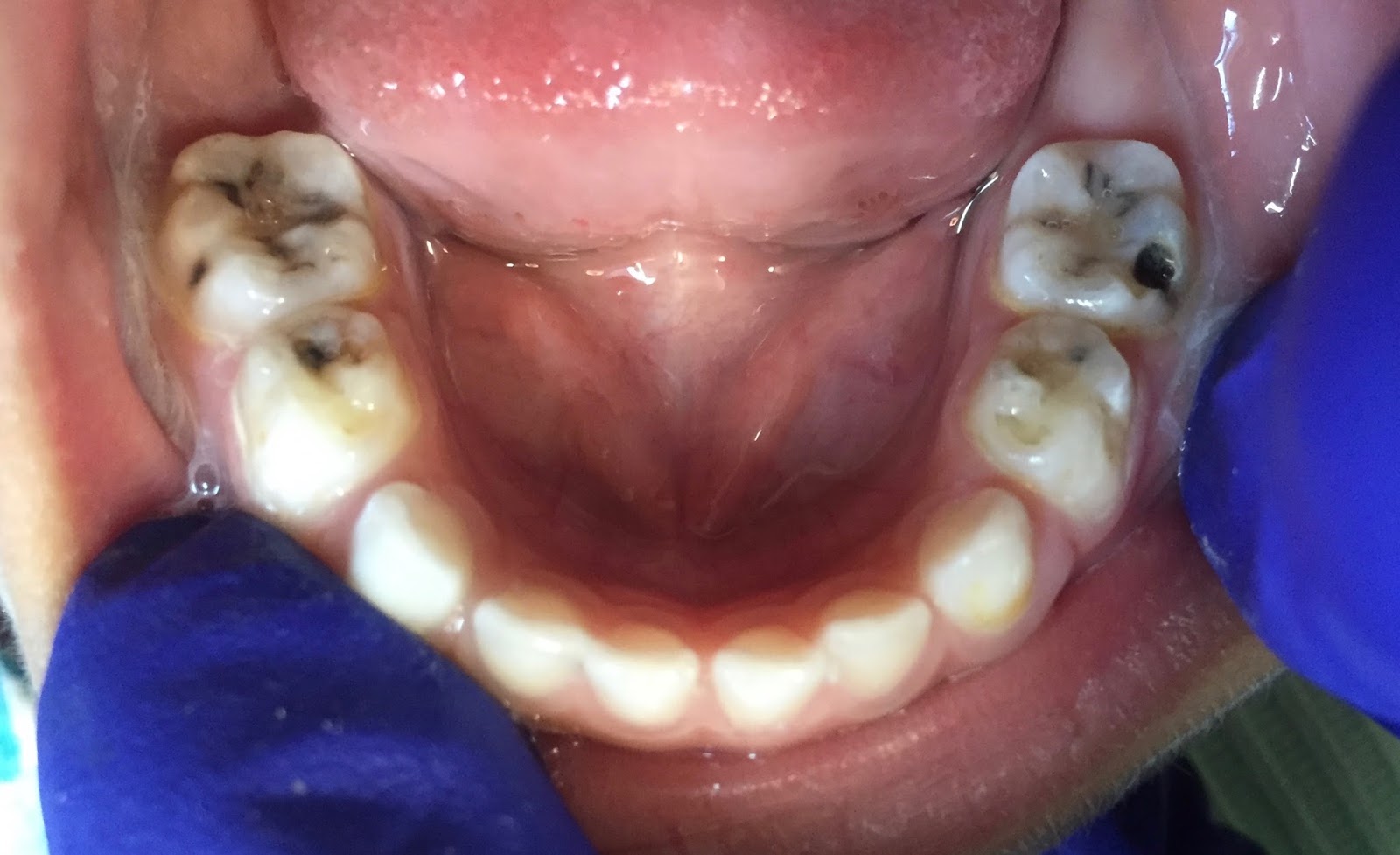 Smiles that make a Difference