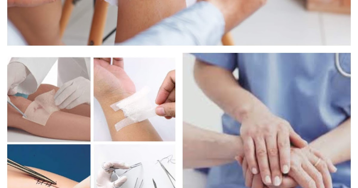 Técnica de Procedimiento de Curación