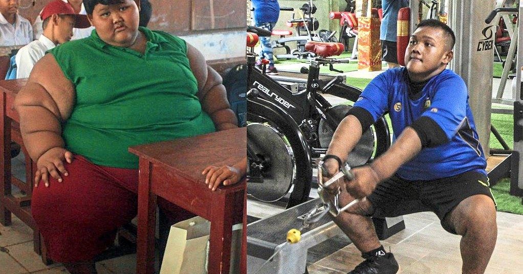 Incredible Story Of The Fattest Kid In The World Who Lost 105 kg