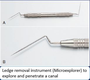 What is Ledge, Zipping, Strip Perforation and Apical Transportation in ...