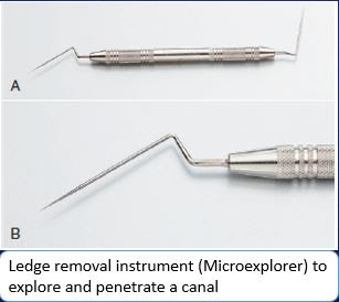 What is Ledge, Zipping, Strip Perforation and Apical Transportation in ...