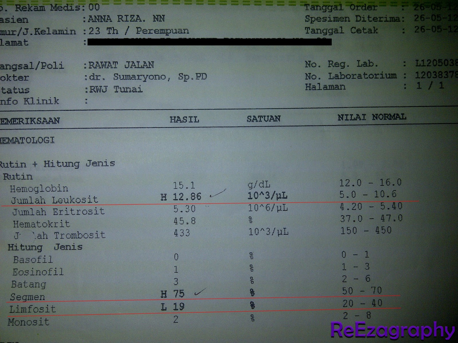 Operasi Usus Buntu - Passion is Love