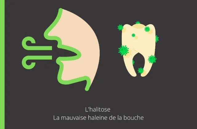 L'halitose, causes et traitement - MEGA dentist