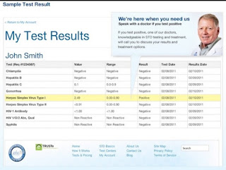 how long do std test results take