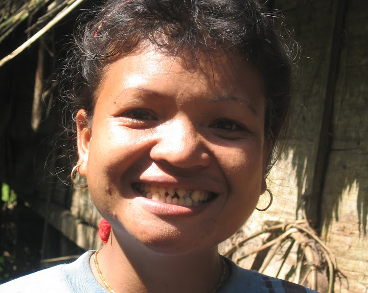 Deformutilation: Sharpened Teeth