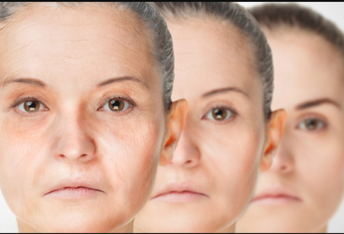 5 Penyebab Penuaan Dini