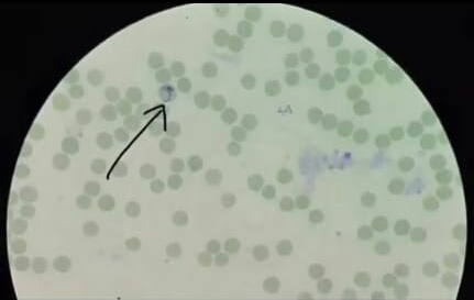 Hematologi III: Laporan Praktikum II