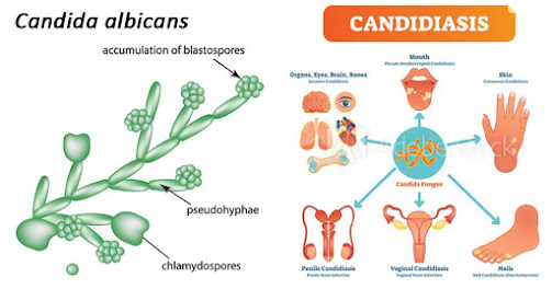 Merlins Micro World: CANDIDIASIS