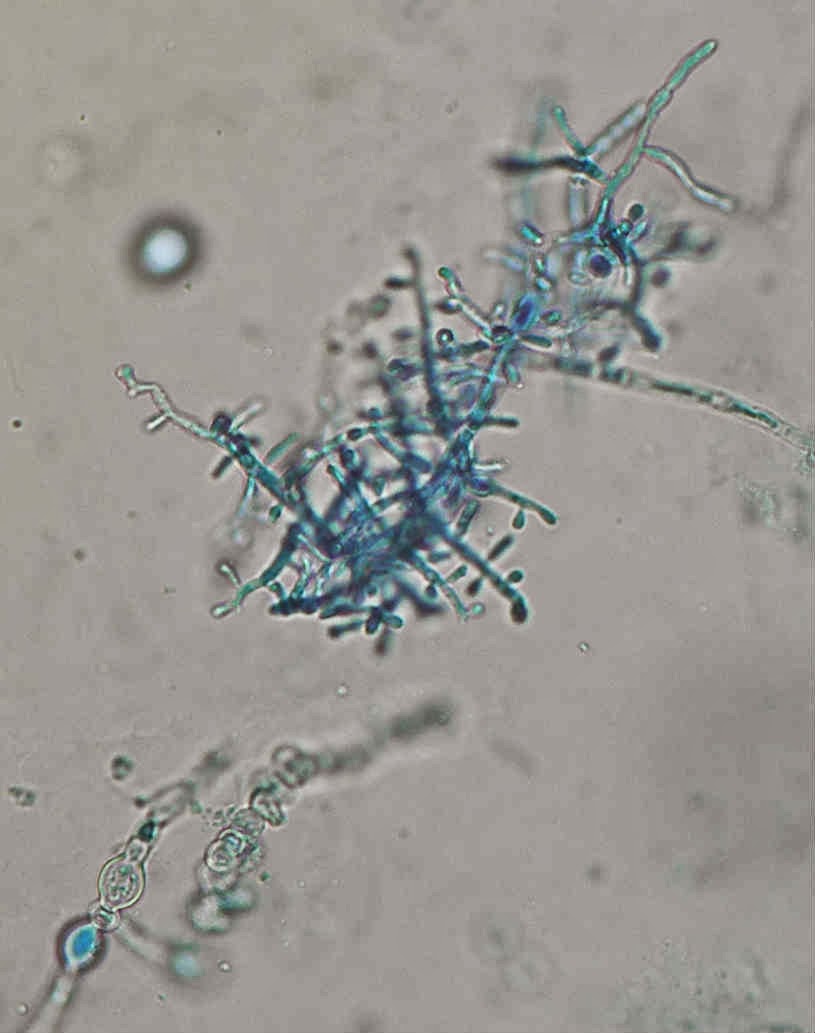 ATLAS MICOLOGIA: TRICHOPHYTON VERRUCOSUM