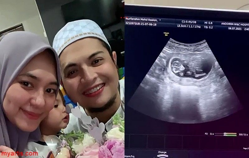 MYARTIS.COM | MYARTIS | MY | ARTIS: ISTERI HAMIL 3 BULAN - IPPO HAFIZ BAKAL TIMANG ANAK KEDUA