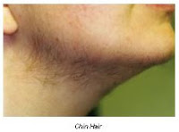 Threading Blog: Unwanted Facial Hair/ Hirsutism
