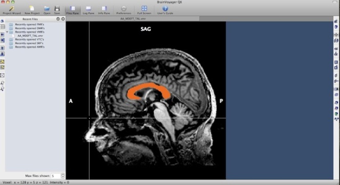 Neuroimaging Made Easy : Brainvoyager QX tips and tricks 2; Create a 3d ...