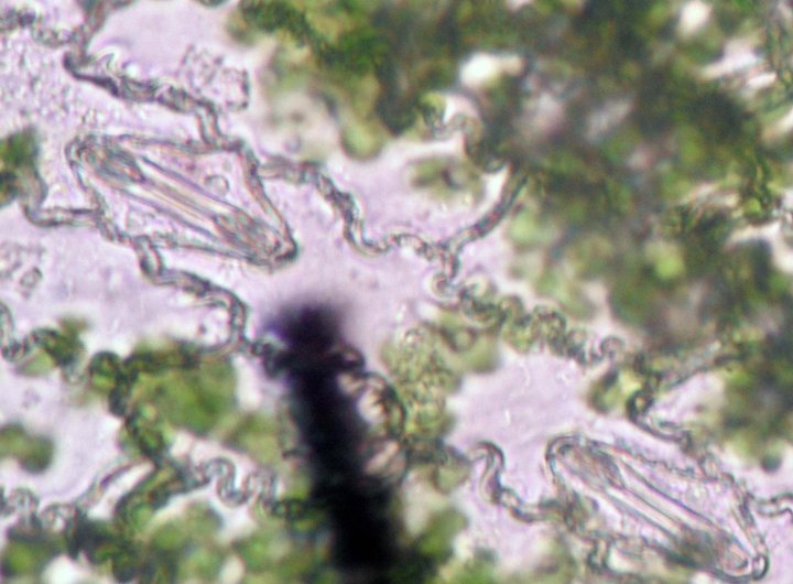 jaringan epidermis ~ Prapatan SPS