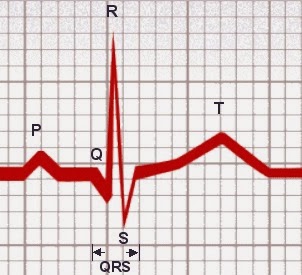 AzamRussia: ECG for Dummies