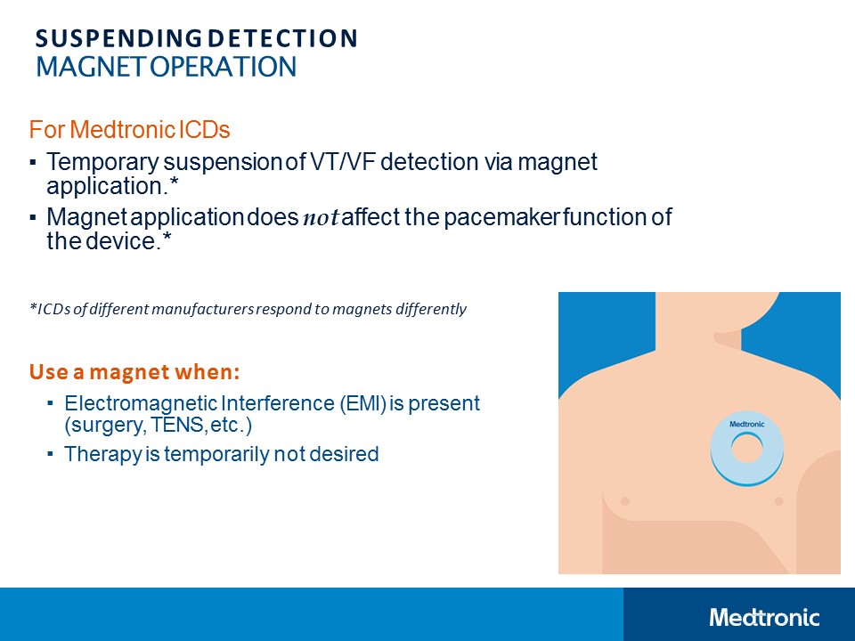 CVT Mohd Farid: Concept Of ICD Technology-Sensing & Detection-Medtronic ...