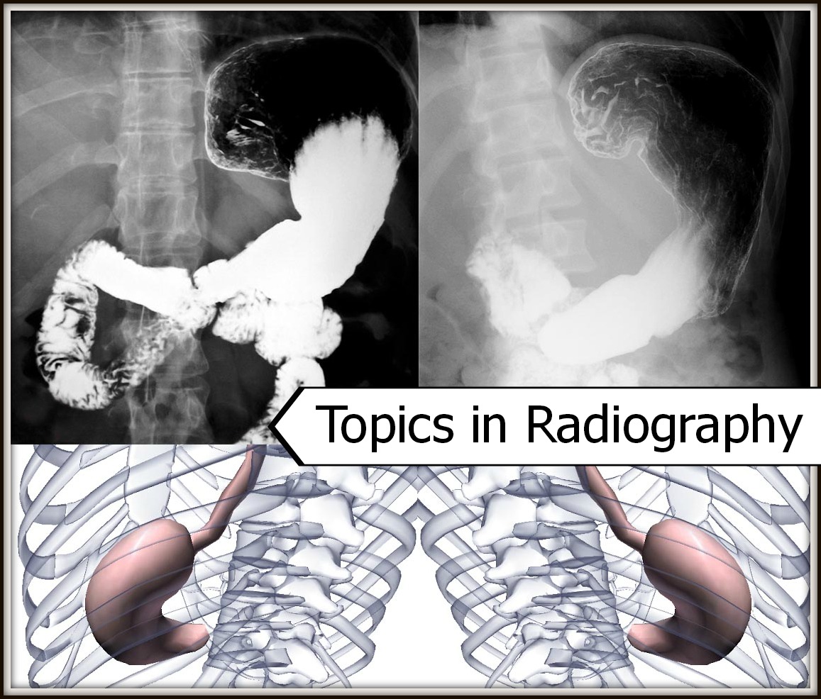 Topics in Radiography: UGI Image Evaluation