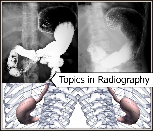 Topics in Radiography: UGI Image Evaluation