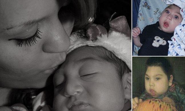 Obehi Okoawo's Blog: Child Born Without Brain Dies After Miraculous 3 ...