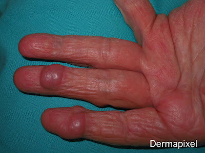 Dermapixel: diciembre 2019