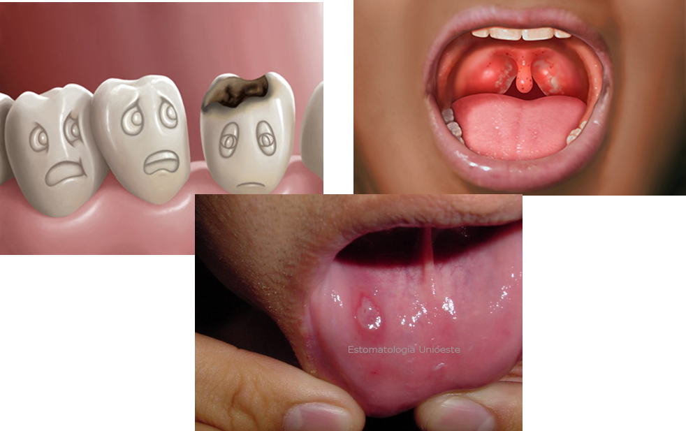 ODONTOLOGIA 1º CICLO: HALITOSIS