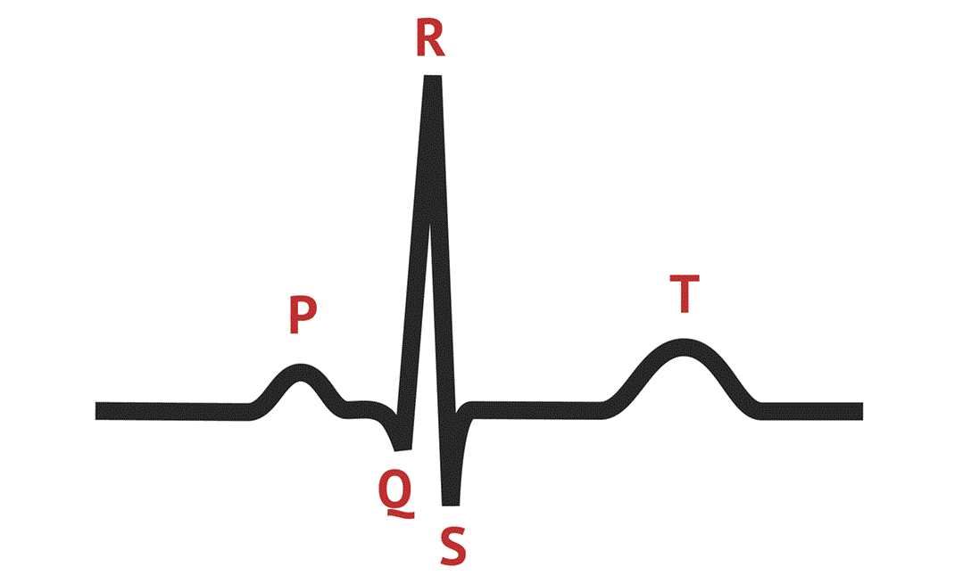 ECG Changes in Electrolytes Imbalance : Theory (YouTube Class 1.3 )