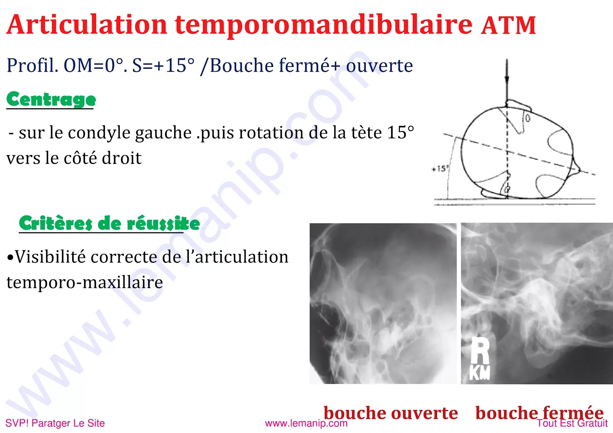 Incidences Radiologique Et Constantes Et Critères De Réussite PDF