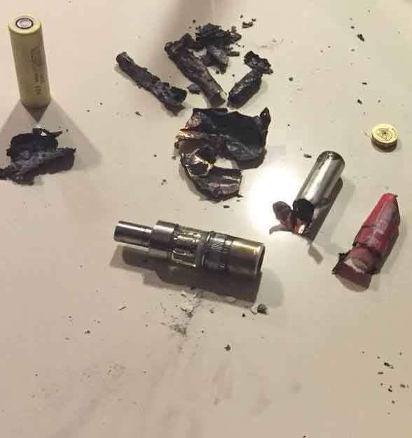 GAMBAR Lelaki Cedera Akibat Vape Beliau Meletup! ~ Timun Bulat