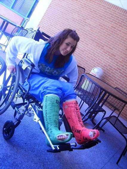 castgirls: toe protector casts