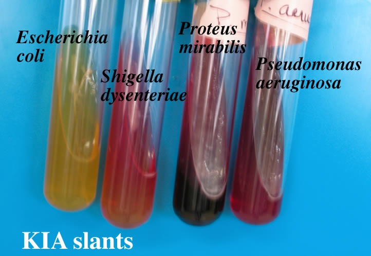 Pseudomonas Aeruginosa Agar Slant