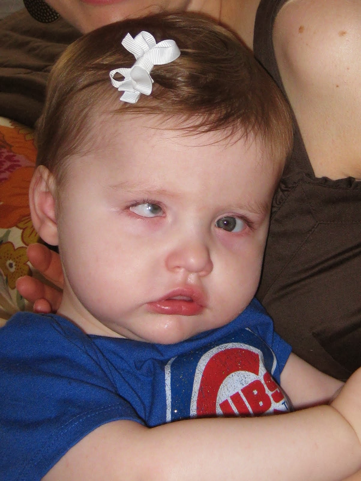 Medical Treatment Pictures-for Better Understanding: Aicardi Syndrome