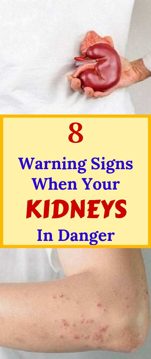 8 Warning Signs When Your Kidneys In Danger | Wellness Today