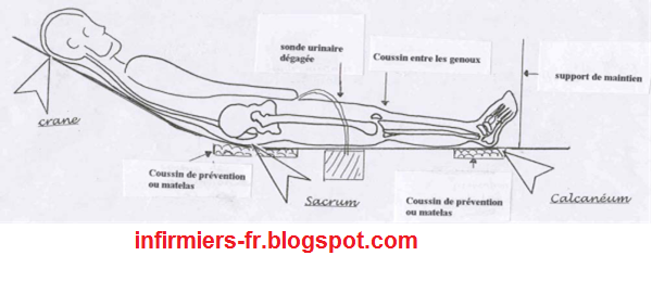 Les différentes positions du malade (cours) ~ Soins infirmiers En France