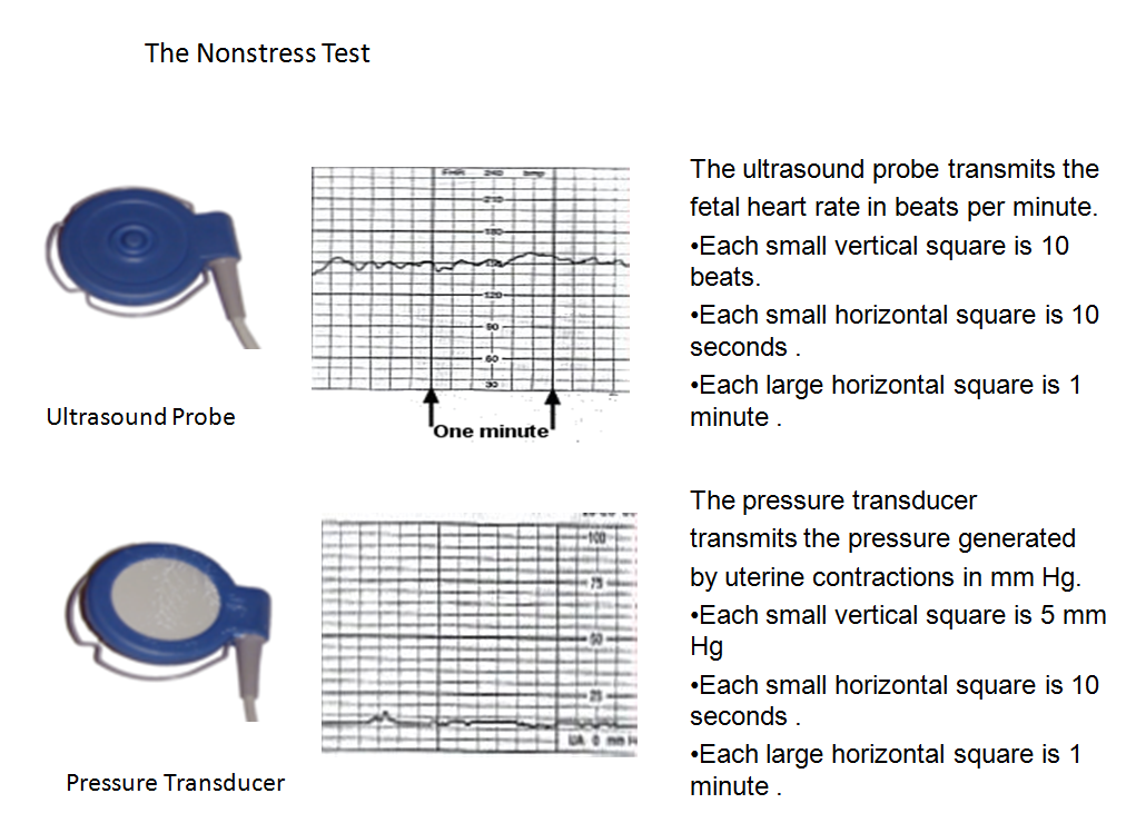 CARDIOTOGRAPH (CTG) untuk Pemeriksaan Kesehatan Janin | Biomedical ...