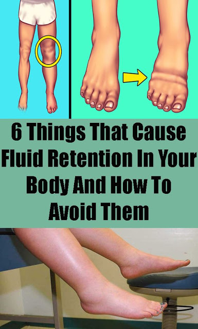 6 Things That Cause Fluid Retention In Your Body And How To Avoid Them ...