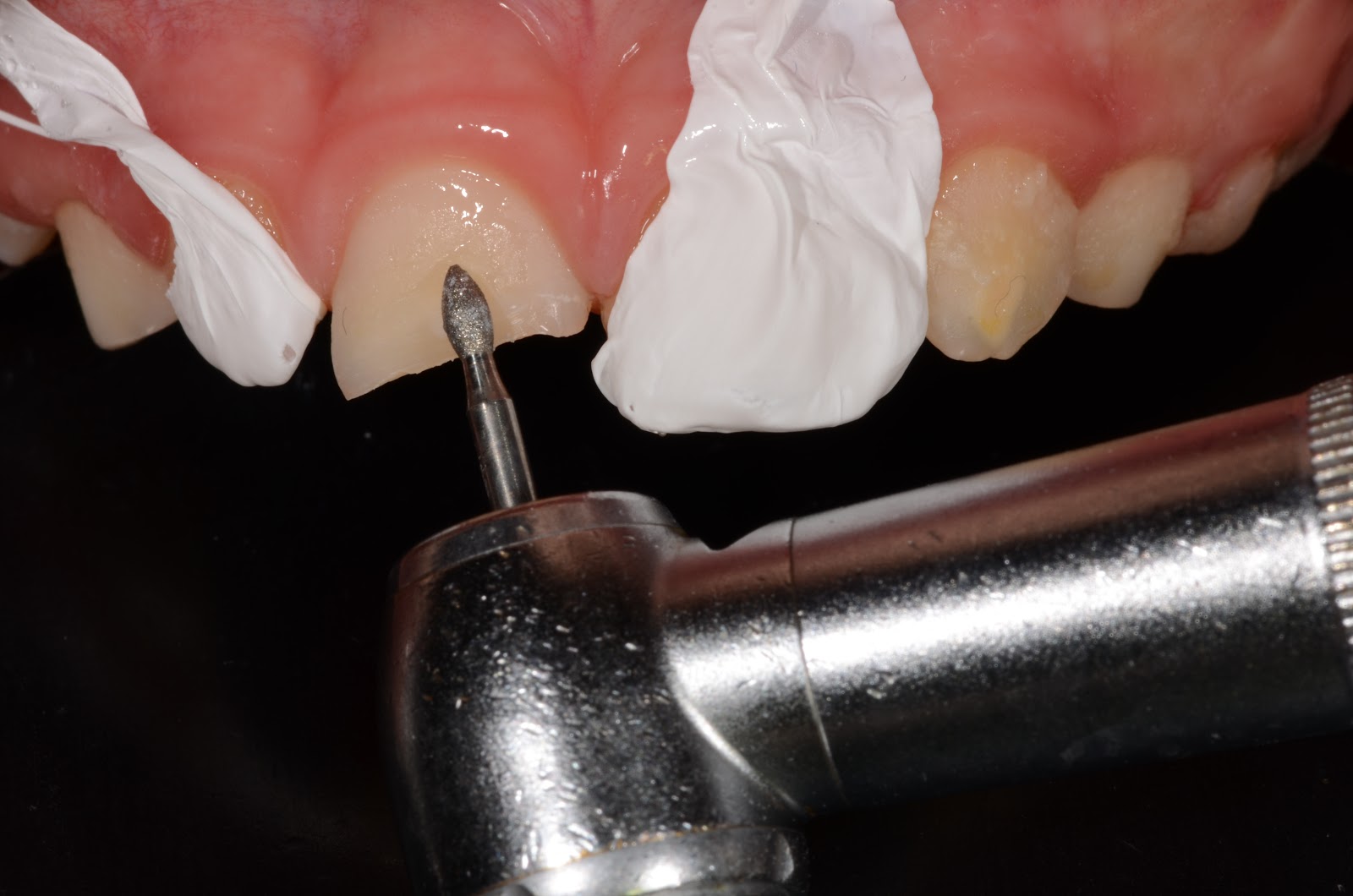 Estética, Belleza y Armonía en odontología