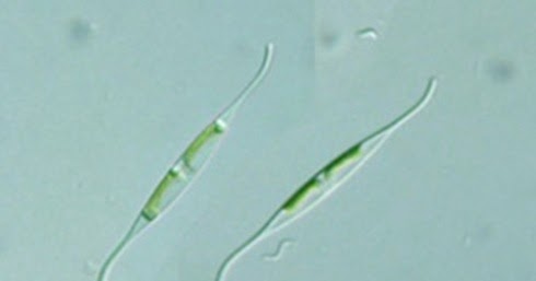 Nitzchia Sp Adalah; Klasifikasi, Morfologi, Habitat Dll - Melek Perikanan