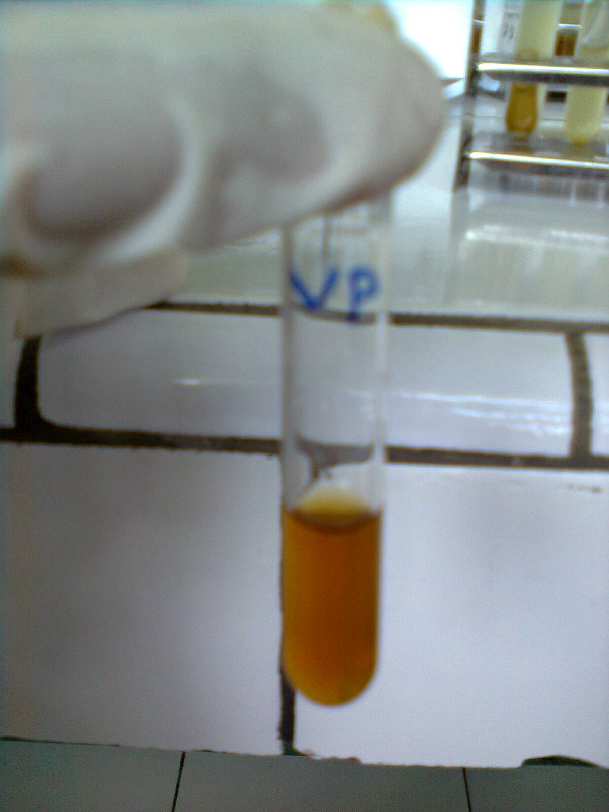 Teenoz Health Analyst: Gambar Hasil Identifikasi Klebsiella