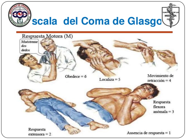LAS MEJORAS EN LA ESCALA DE COMA DE GLASGOW