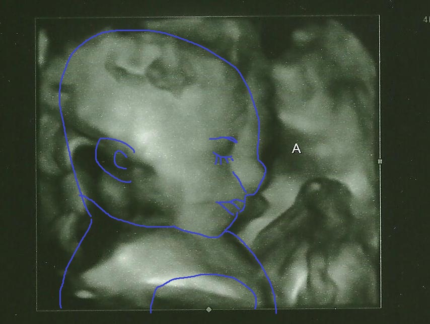 2 New Rubys: 31 Weeks: Growth Scan + MFM appt